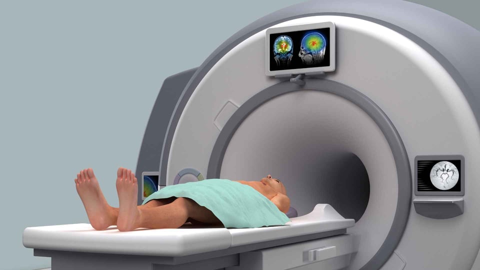 Resonancia Magnética: Para Qué Sirve